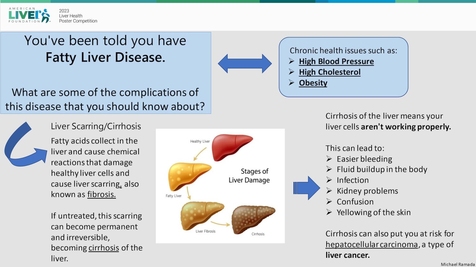 Fatty Liver Disease – 2025 Liver Health Poster Competition